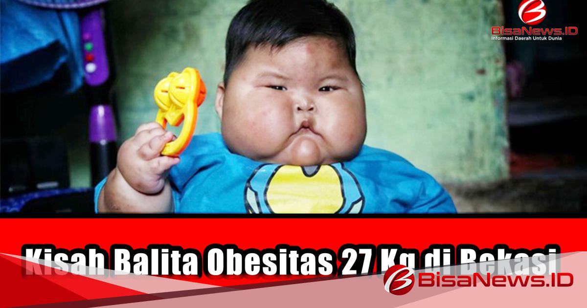 Kisah Balita Obesitas 27 Kg Di Bekasi